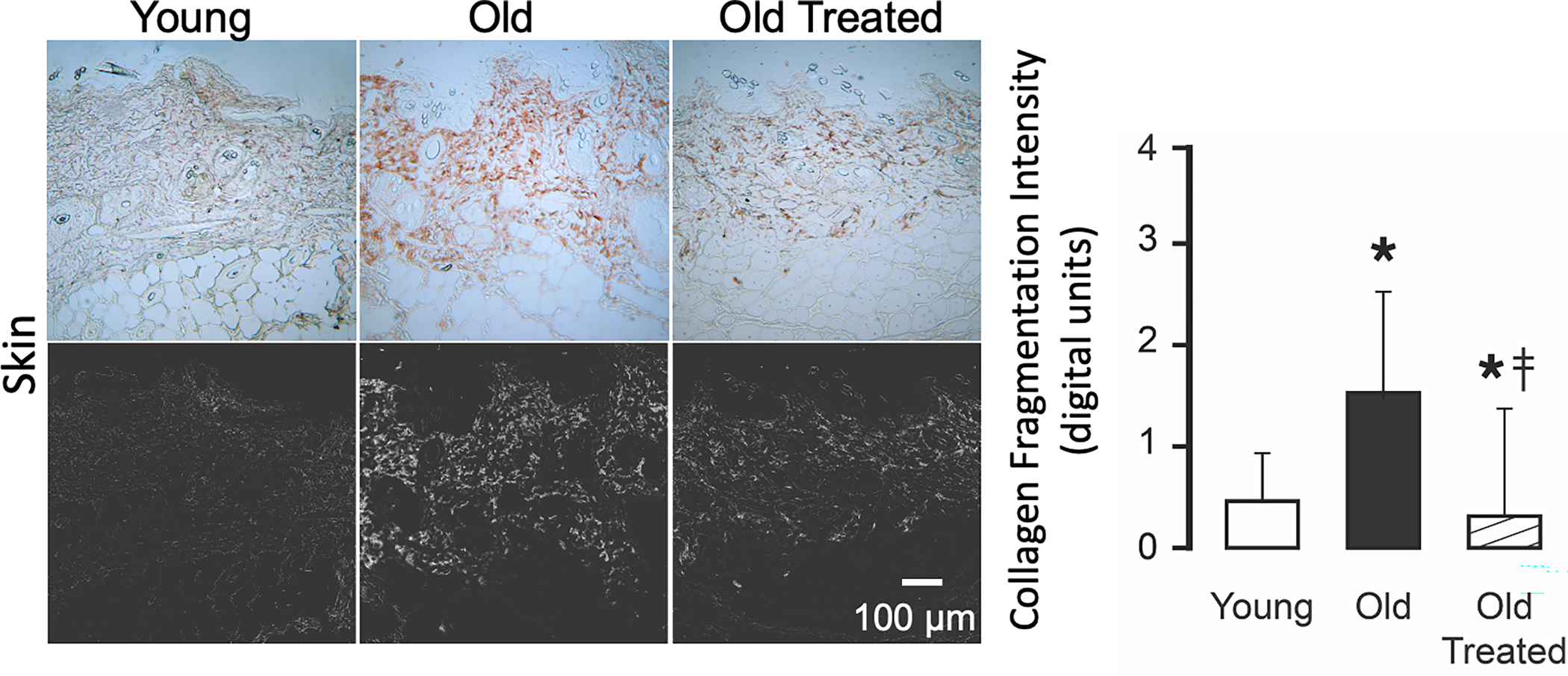 Aging Unveiled: CHPs Reveal Widespread Tissue Damage and Reversible Co ...