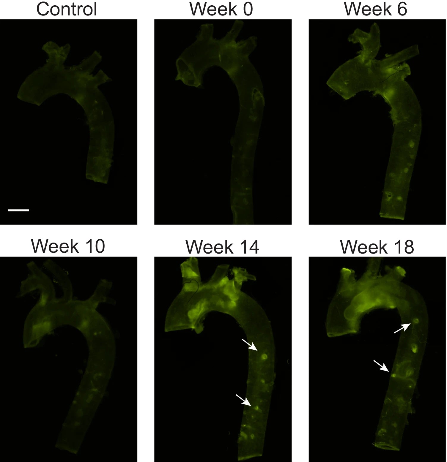 CHPs Detect Early Arterial Damage in Atherosclerosis – 3Helix Inc