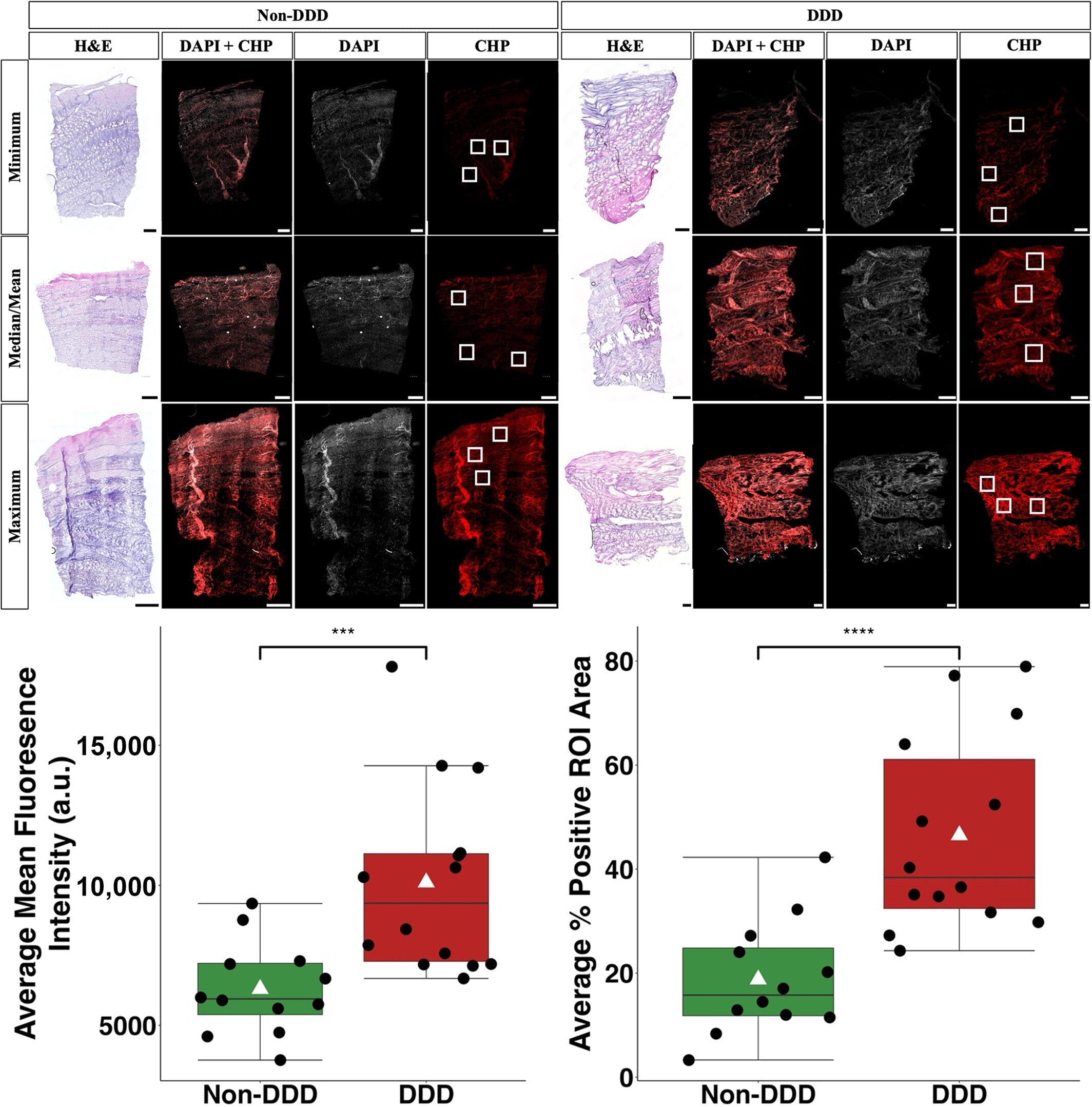 How Collagen Hybridizing Peptides Reveal Hidden Molecular Damage Behin ...