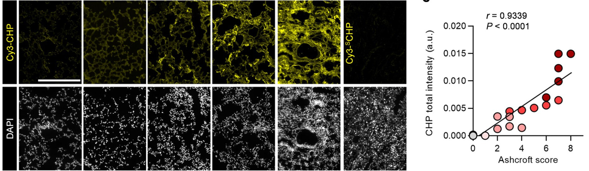Using Collagen Hybridizing Peptides to Improve IPF Diagnosis and Imagi ...