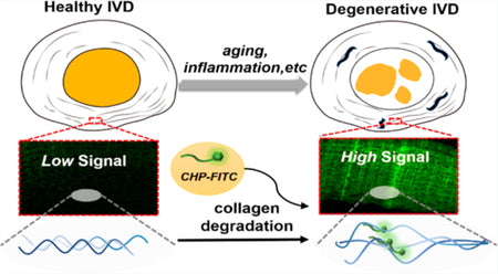 CHPs: Fast IVD Degeneration Detection – 3Helix Inc