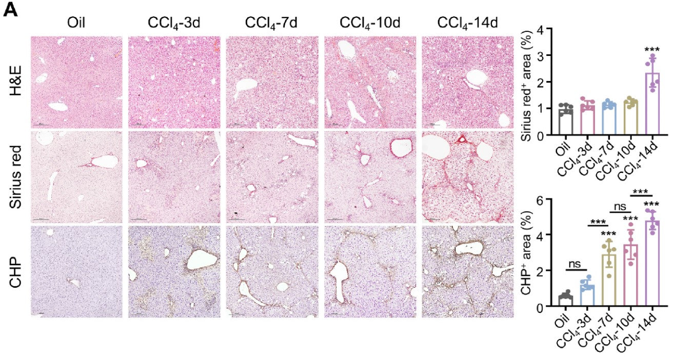 CHPs: Faster Liver Fibrosis Detection – 3Helix Inc