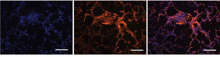Intracellular Hydroxyproline Imprinting Following Resolution of Bleomy ...
