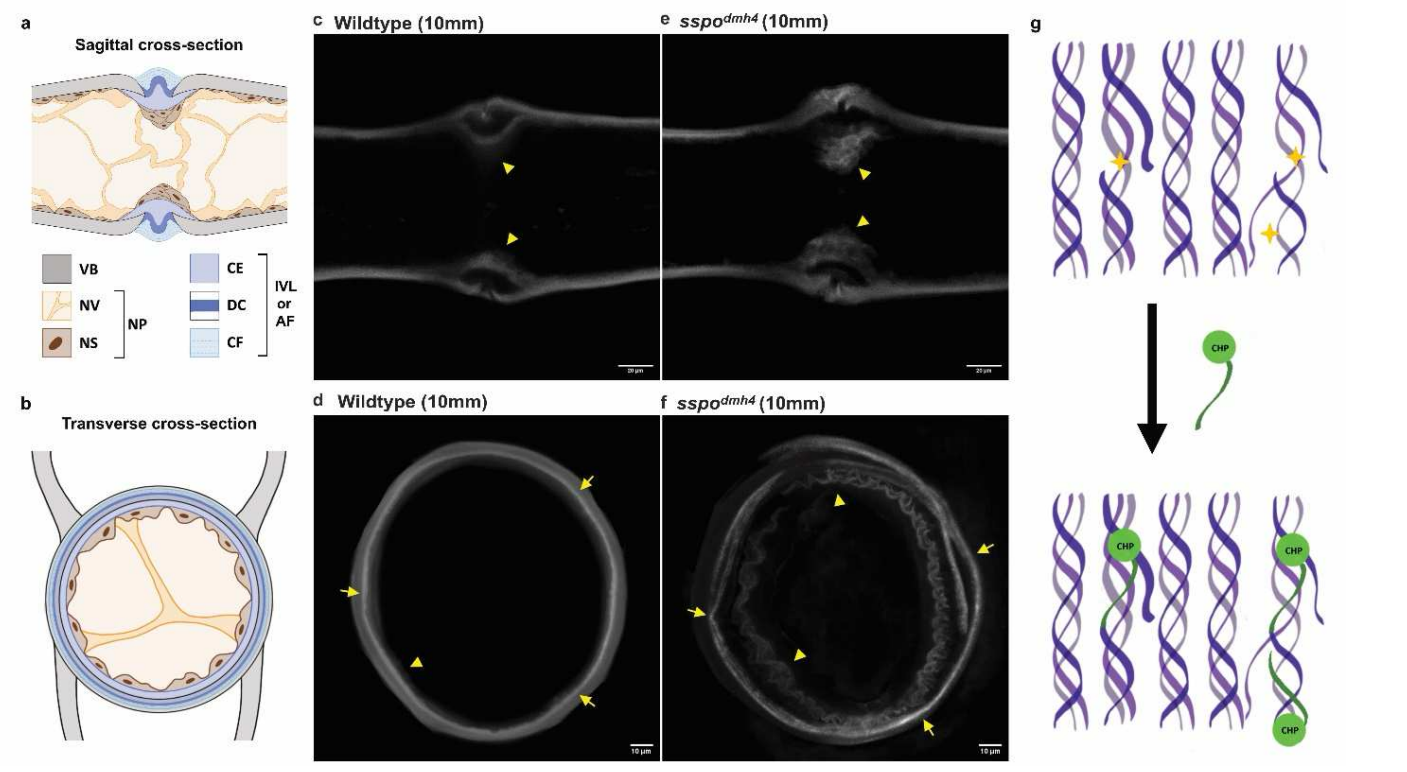 CHPs: Unraveling the Role of Oxidative stress in Scoliosis – 3Helix Inc