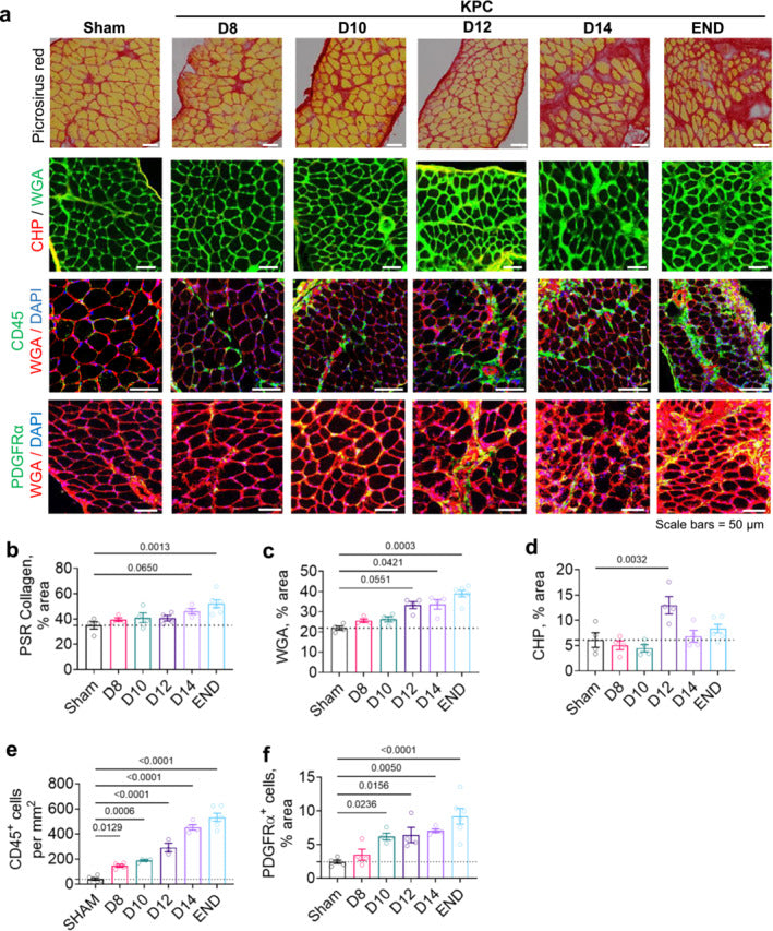Pinpointing Fibrosis: How Collagen Hybridizing Peptides Illustrate Mus ...