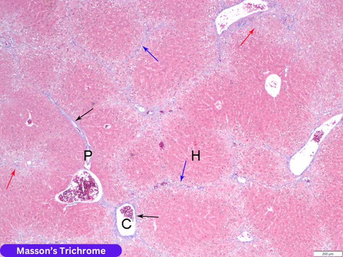 Superior Collagen Staining - CHPs vs Masson's Trichrome – 3Helix Inc
